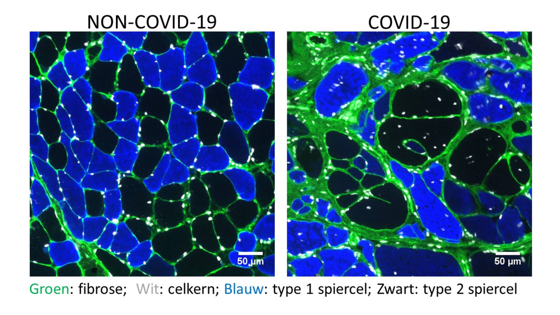 Tast covid-19 de werking van het middenrif aan? - Balans en Energie